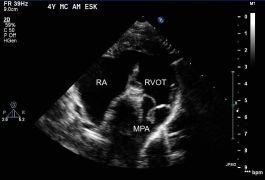 INTRODUCTION TO ECHOCARDIOGRAPHY